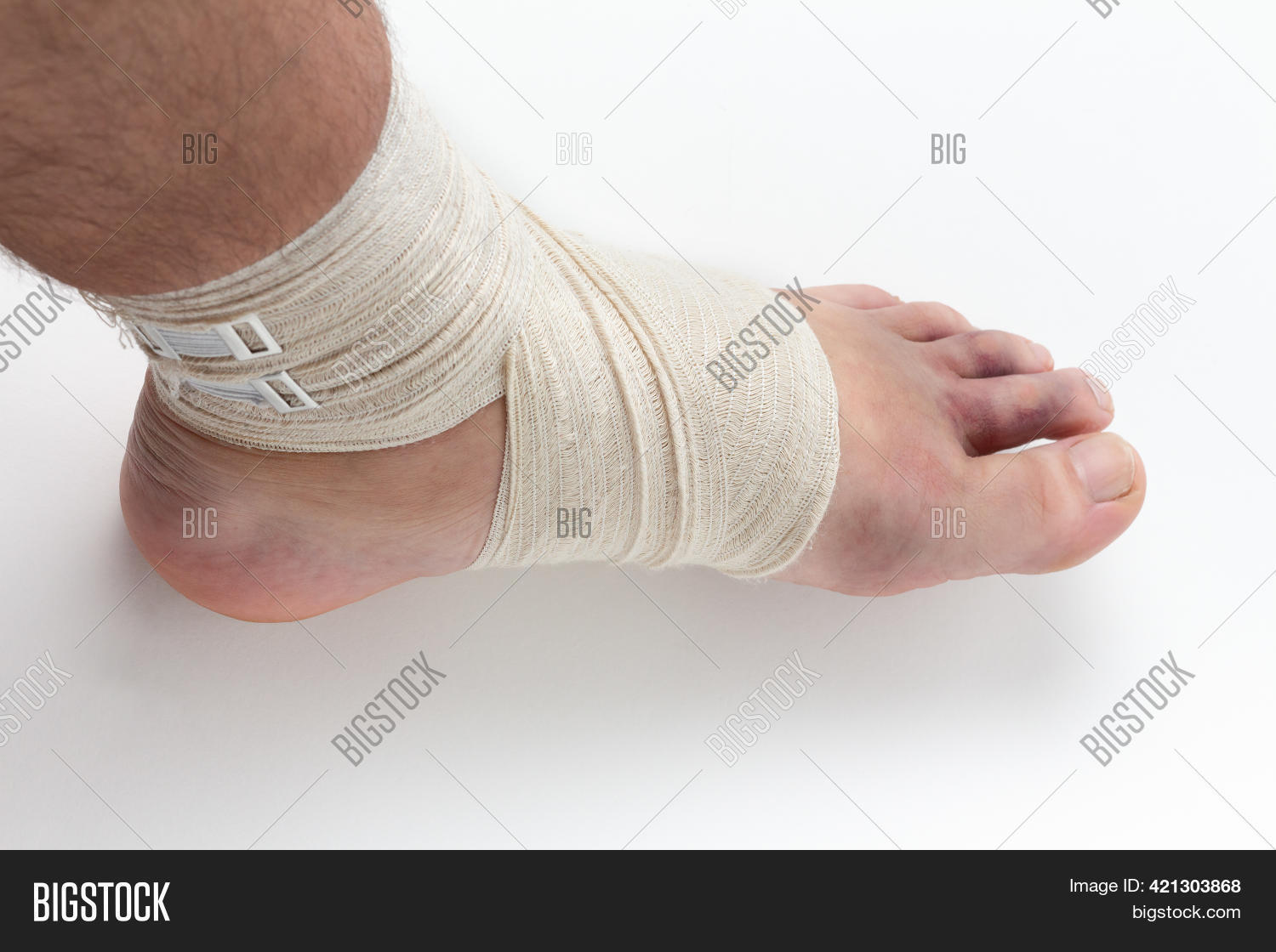 Bandaged Ankle Foot Image & Photo (Free Trial) | Bigstock