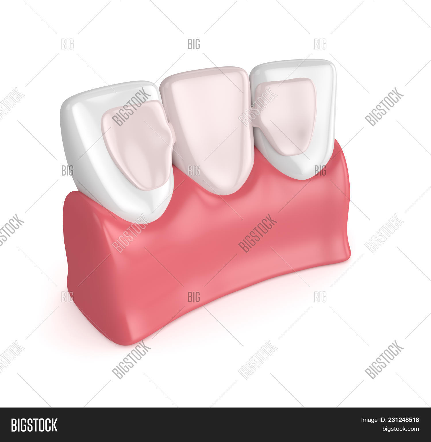 3D Render Teeth Dental Image & Photo (Free Trial) | Bigstock