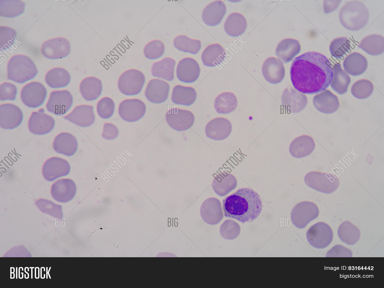 Blood Smear Often Used Image & Photo (Free Trial) | Bigstock