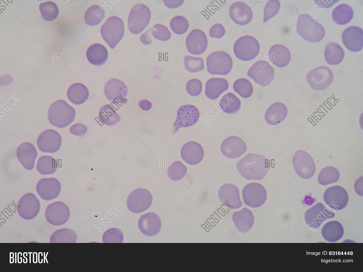 Blood Smear Often Used Image & Photo (Free Trial) | Bigstock