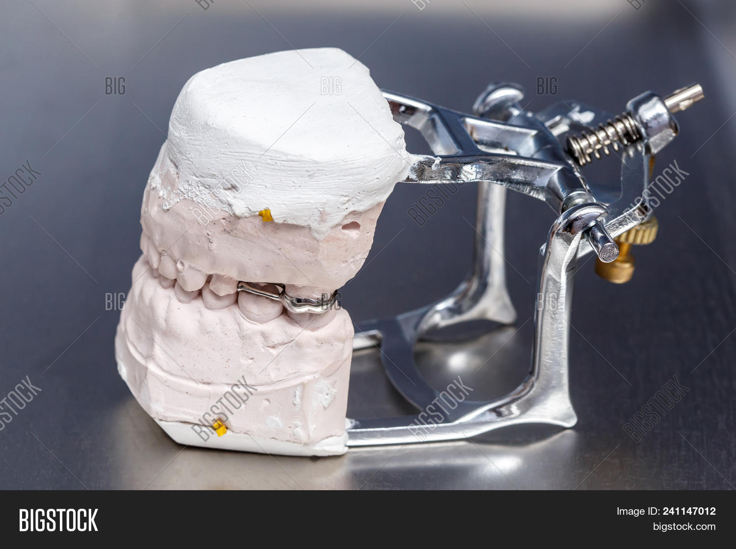 Gray Dental Prosthesis Image & Photo (Free Trial) | Bigstock