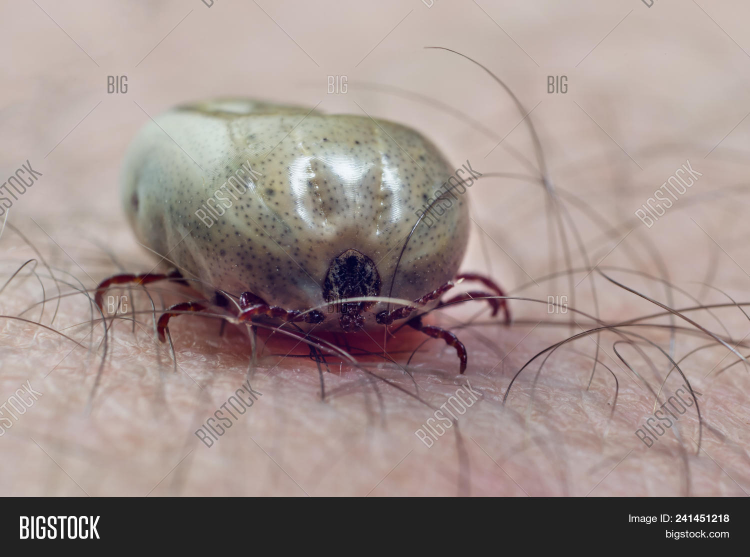Tick Filled Blood Image & Photo (Free Trial) | Bigstock