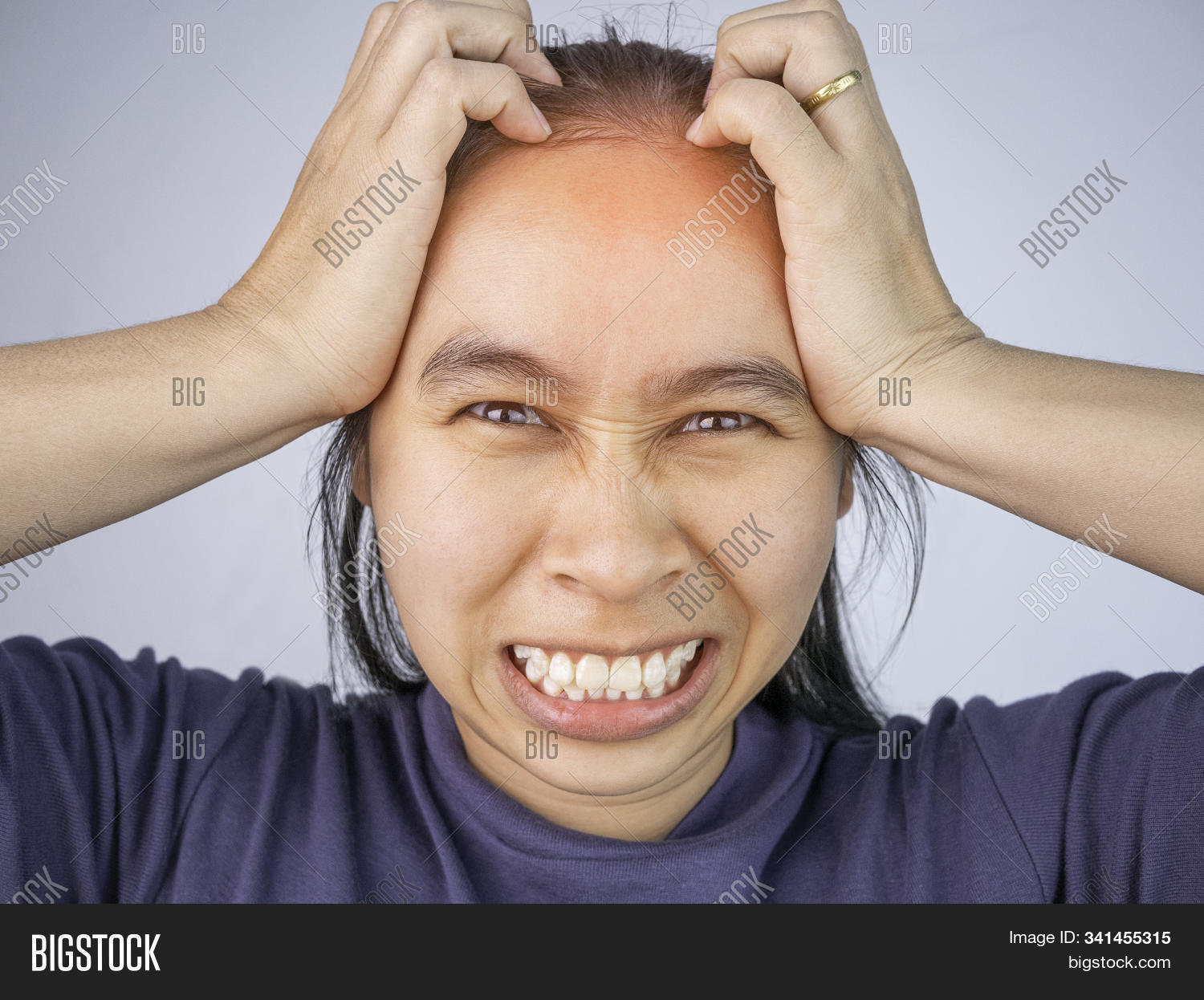 Woman Catching On Head Image & Photo (Free Trial) | Bigstock