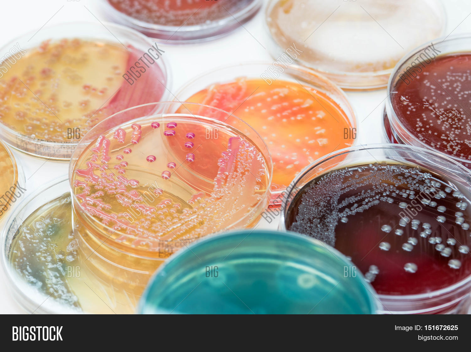 Bacterial Colonies Image & Photo (Free Trial) | Bigstock
