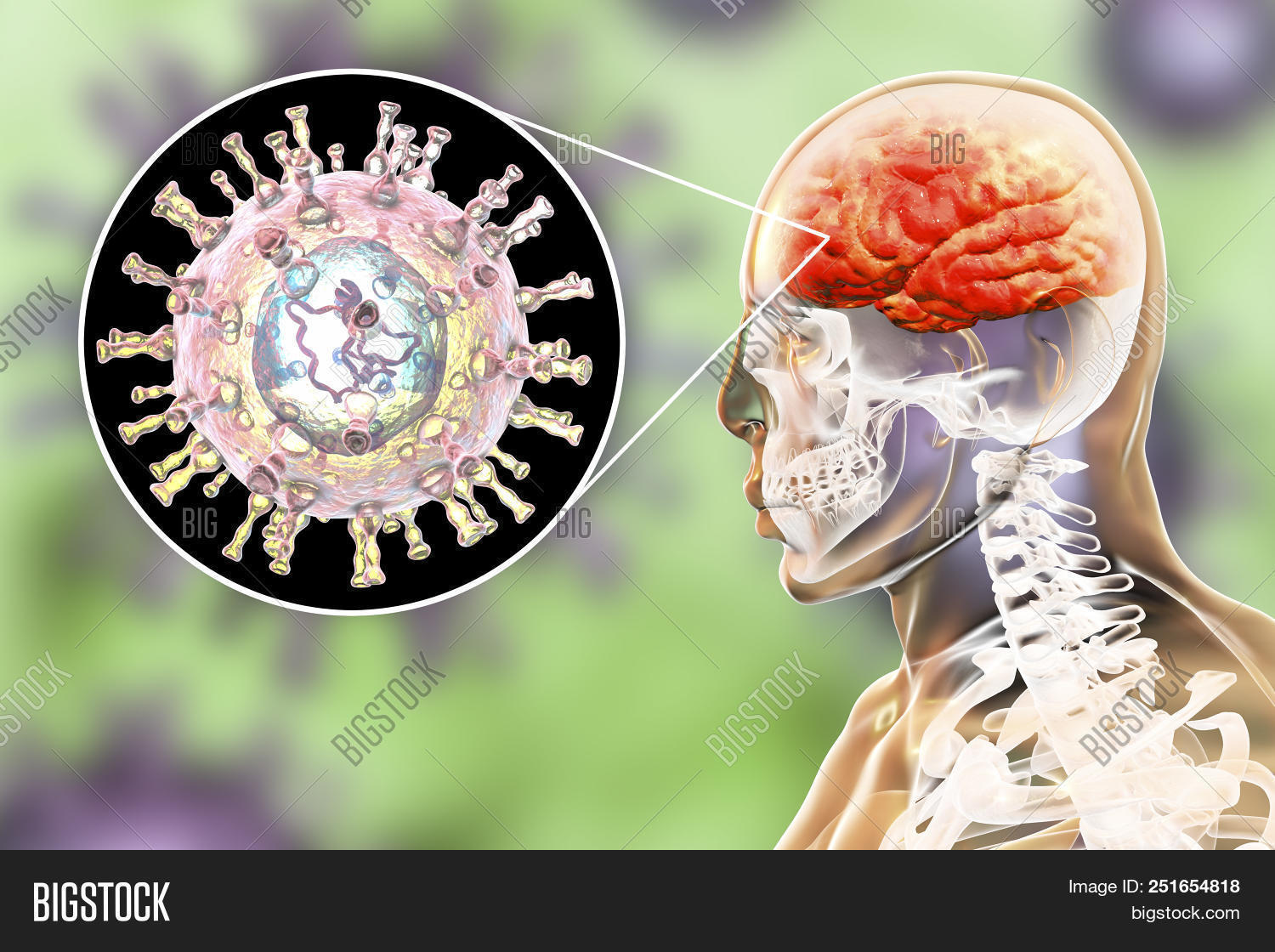 Varicella Zoster Virus Image & Photo (Free Trial) | Bigstock