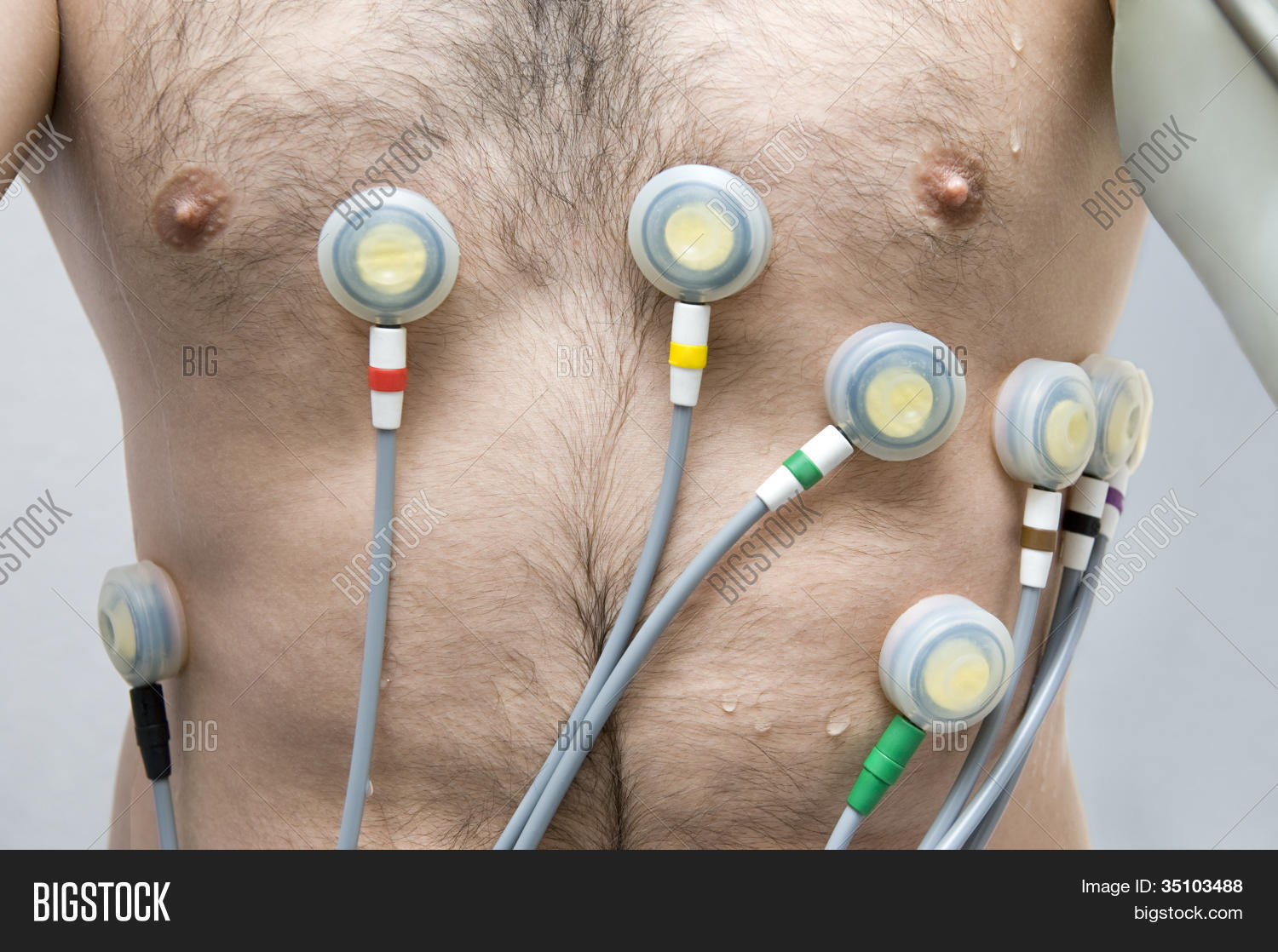 Patient Performing EKG Image & Photo (Free Trial) | Bigstock