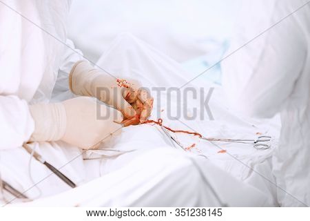 Doctor Surgeon Removes Image & Photo (Free Trial) | Bigstock