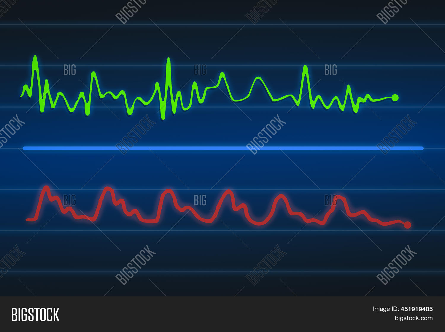 Patient Monitor Image & Photo (Free Trial) | Bigstock
