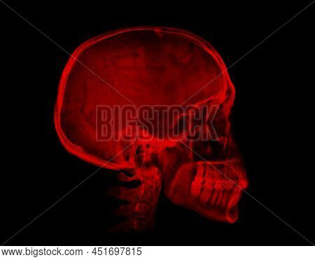 Human Skull. Red X-ray Image & Photo (Free Trial) | Bigstock