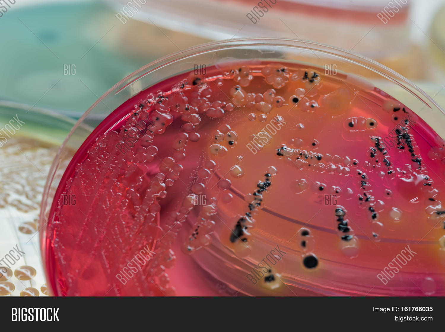 Gram Negative Bacilli Image & Photo (Free Trial) | Bigstock
