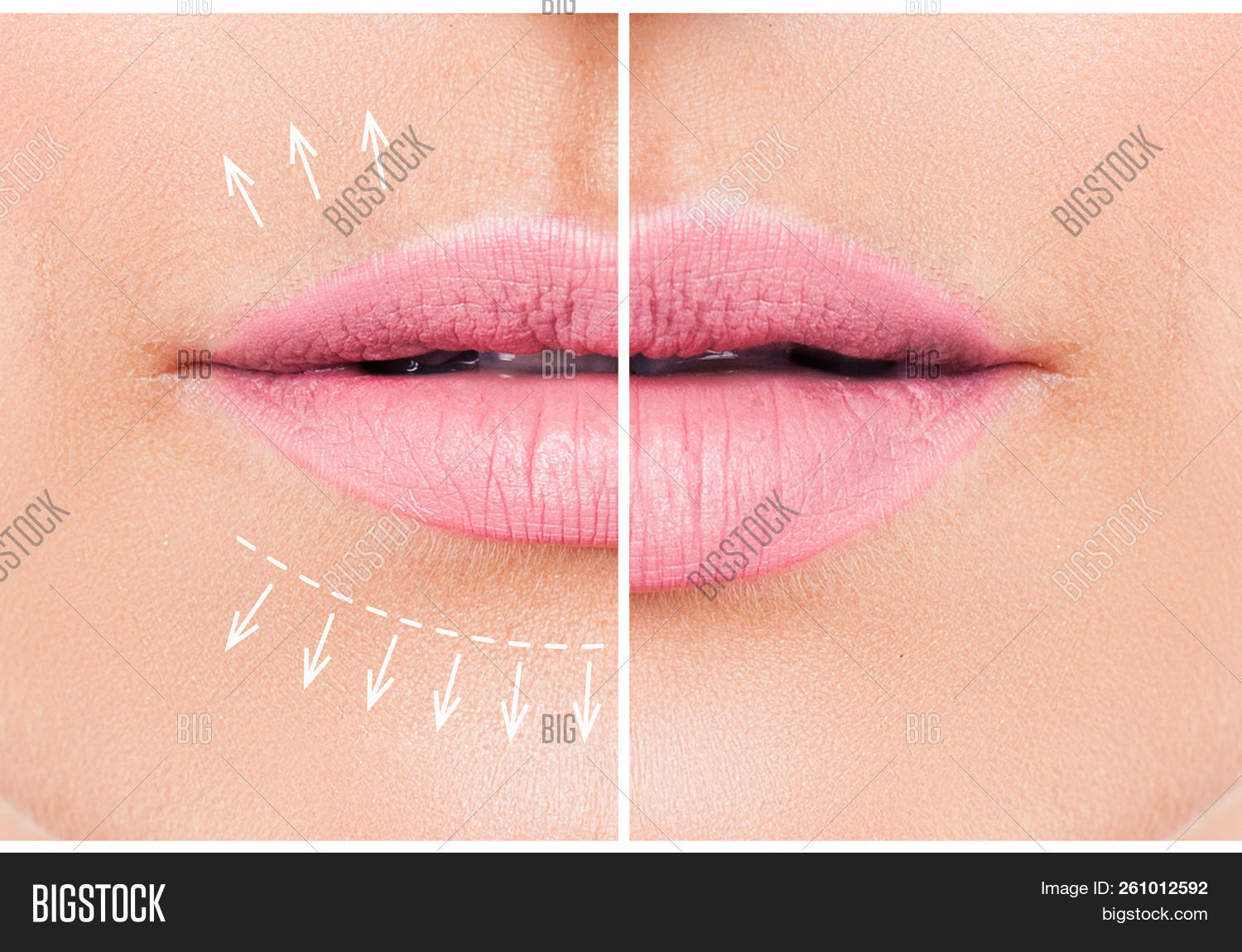 Beautiful Pink Lips Image & Photo (Free Trial) | Bigstock