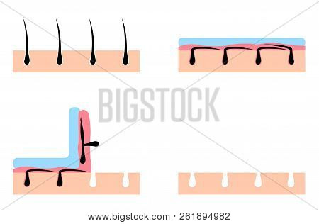 Wax Waxing On Human Vector & Photo (Free Trial) | Bigstock