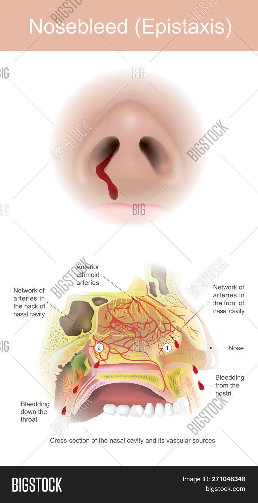 Bleeding Sinuses Image & Photo (Free Trial) | Bigstock