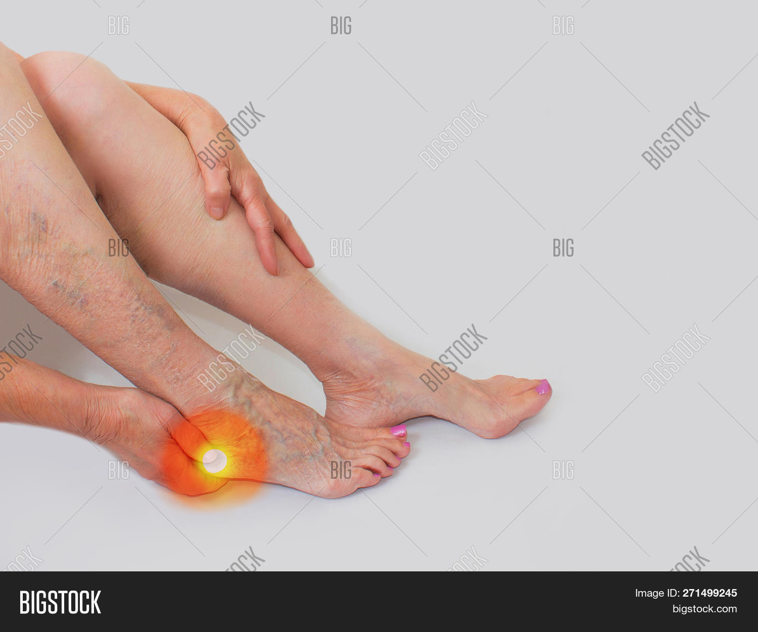 Sole Foot Red Damaged Image & Photo (Free Trial) | Bigstock