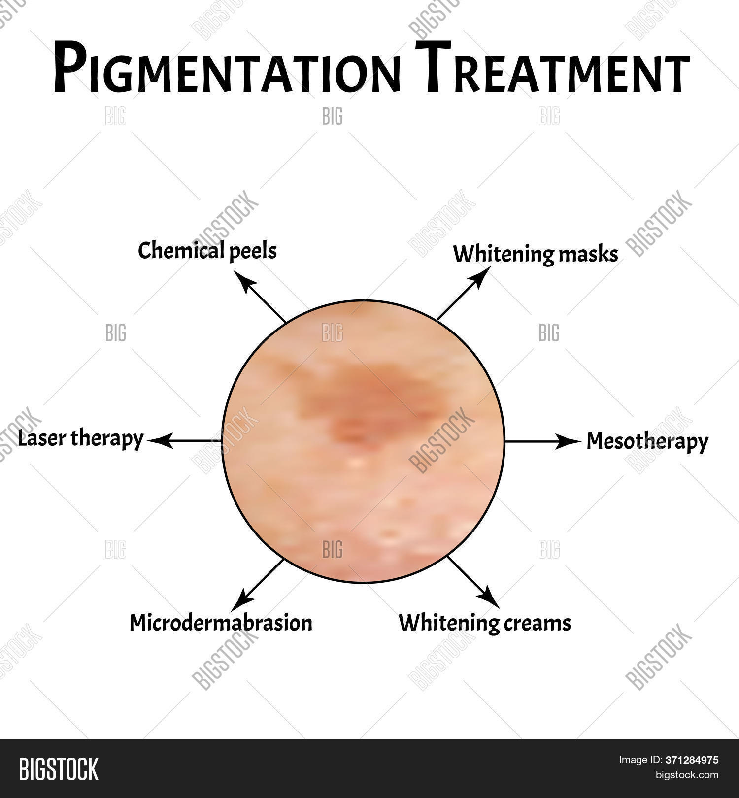Pigmentation On Skin. Image & Photo (Free Trial) | Bigstock
