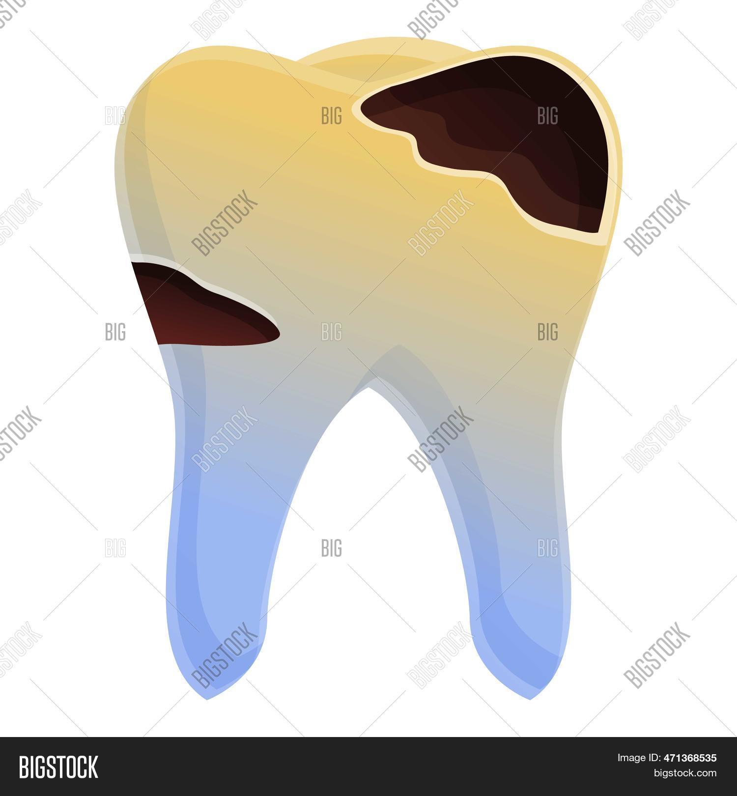 Tooth Decay Icon. Image & Photo (Free Trial) | Bigstock