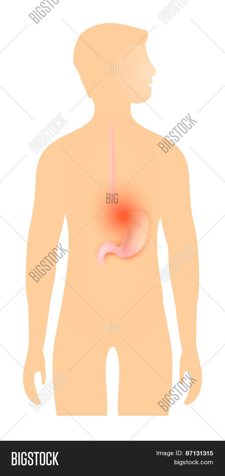 Heartburn Stomach Vector & Photo (Free Trial) | Bigstock