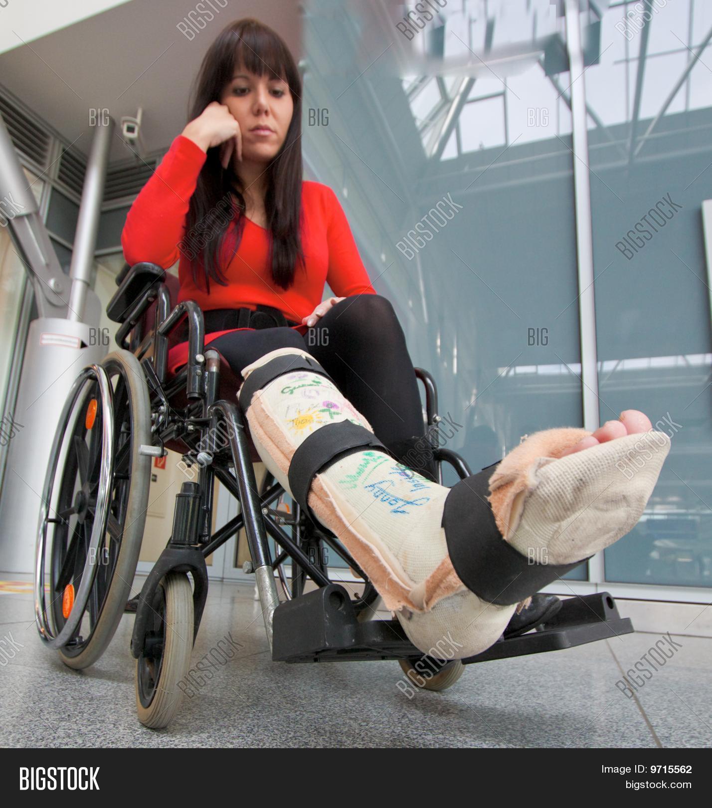 Woman Leg Cast Image & Photo (Free Trial) | Bigstock