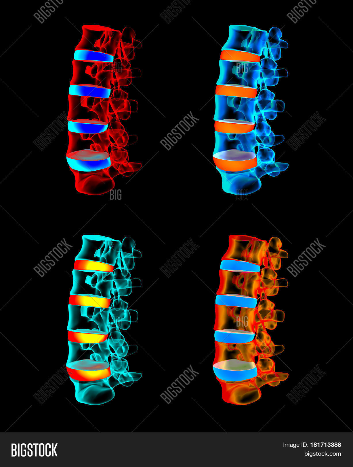 3D Rendered - Spine Image & Photo (Free Trial) | Bigstock