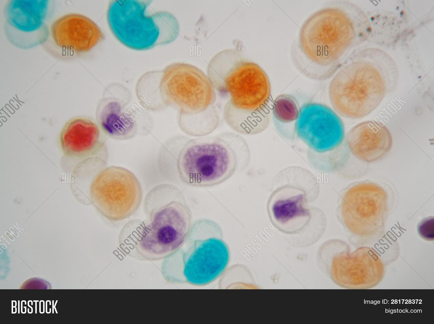 Pollen Grains Image & Photo (Free Trial) | Bigstock