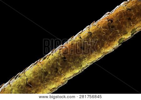 Human Hair Under Image & Photo (Free Trial) | Bigstock