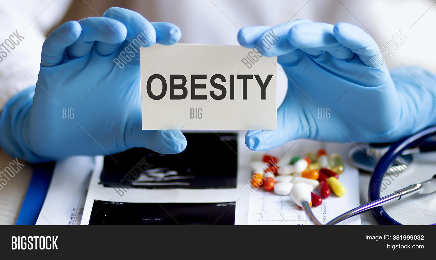Card Text Obesity Image & Photo (Free Trial) | Bigstock