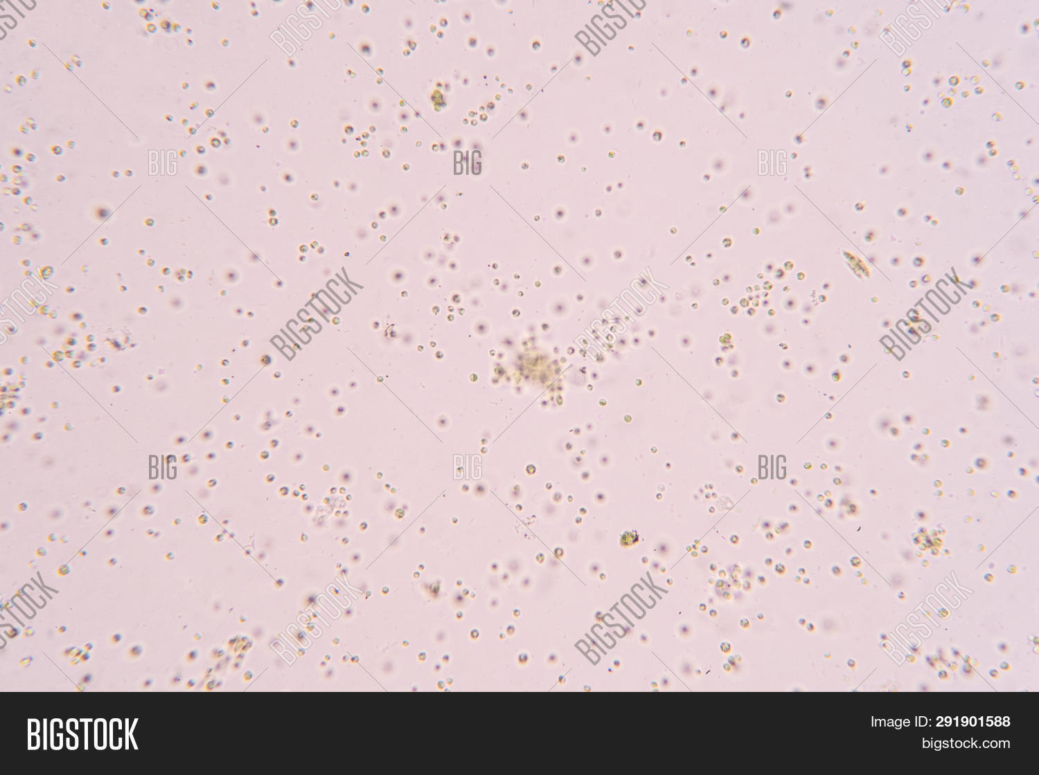 Imagen y foto Chlorella Genus (prueba gratis) | Bigstock