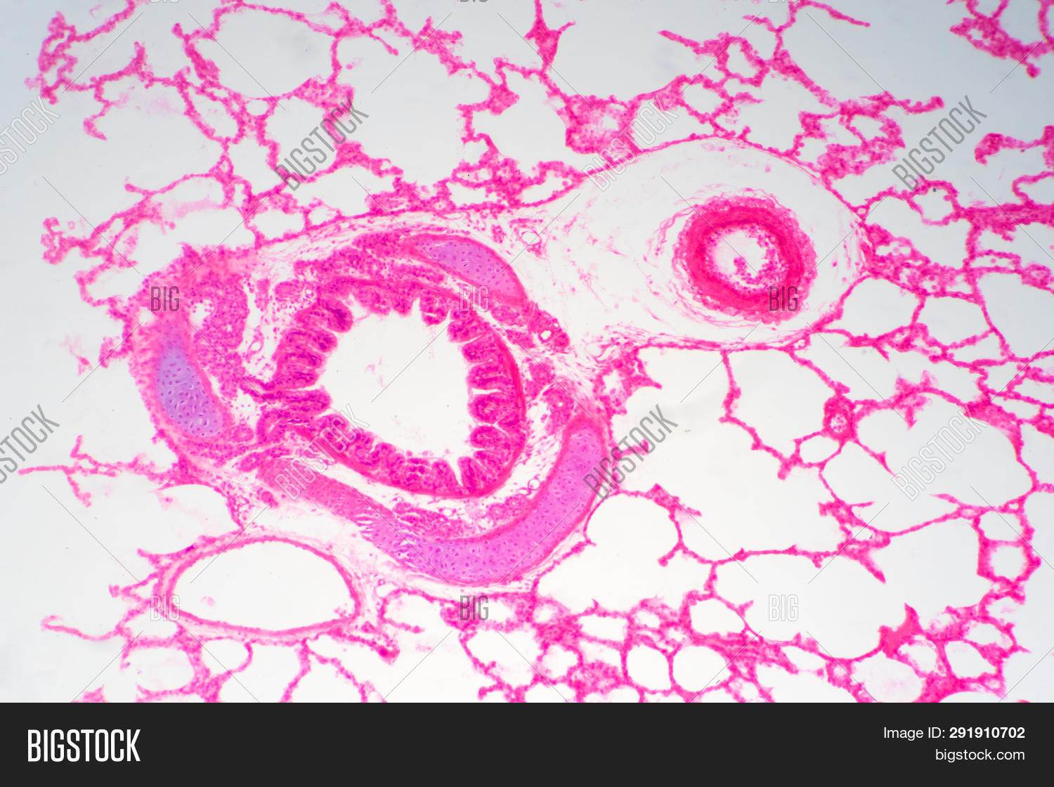 Human Lung Tissue Image & Photo (Free Trial) | Bigstock