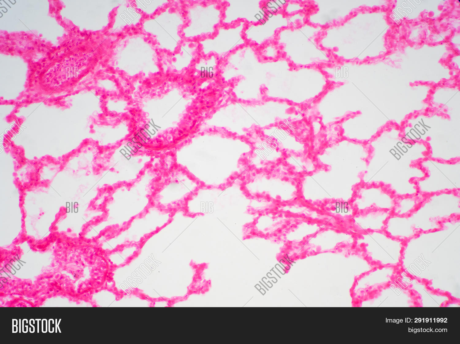Human Lung Tissue Image & Photo (Free Trial) | Bigstock
