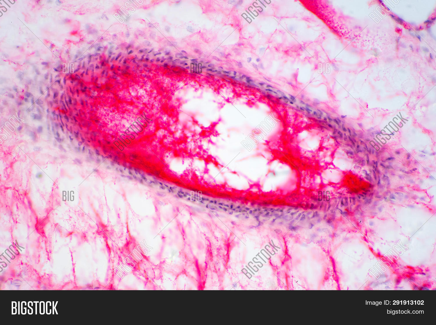 Human Lung Tissue Image & Photo (Free Trial) | Bigstock