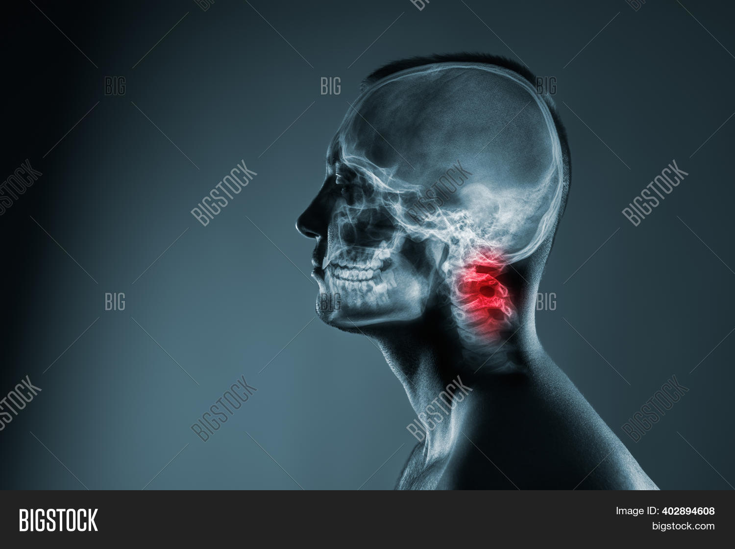 X-ray Mans Head. Image & Photo (Free Trial) | Bigstock