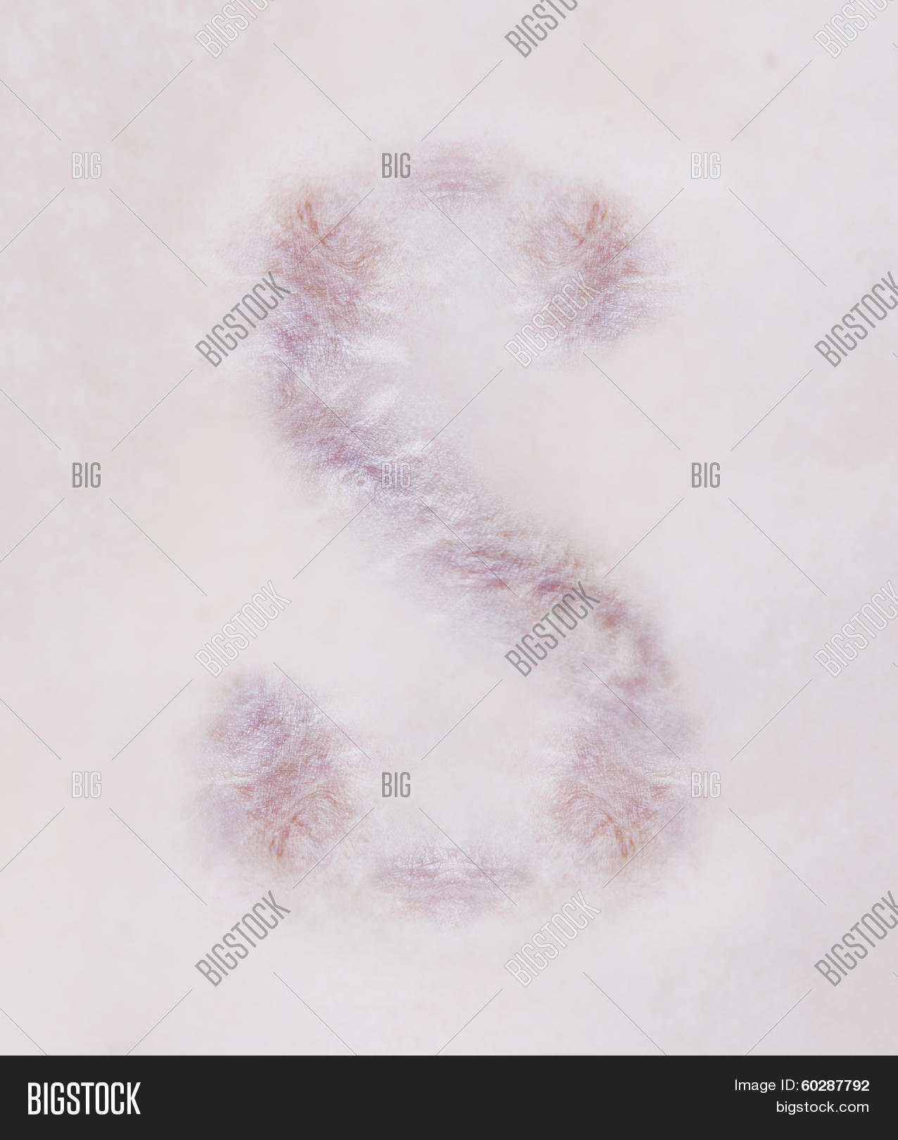Scar Letter S On Human Image & Photo (Free Trial) | Bigstock