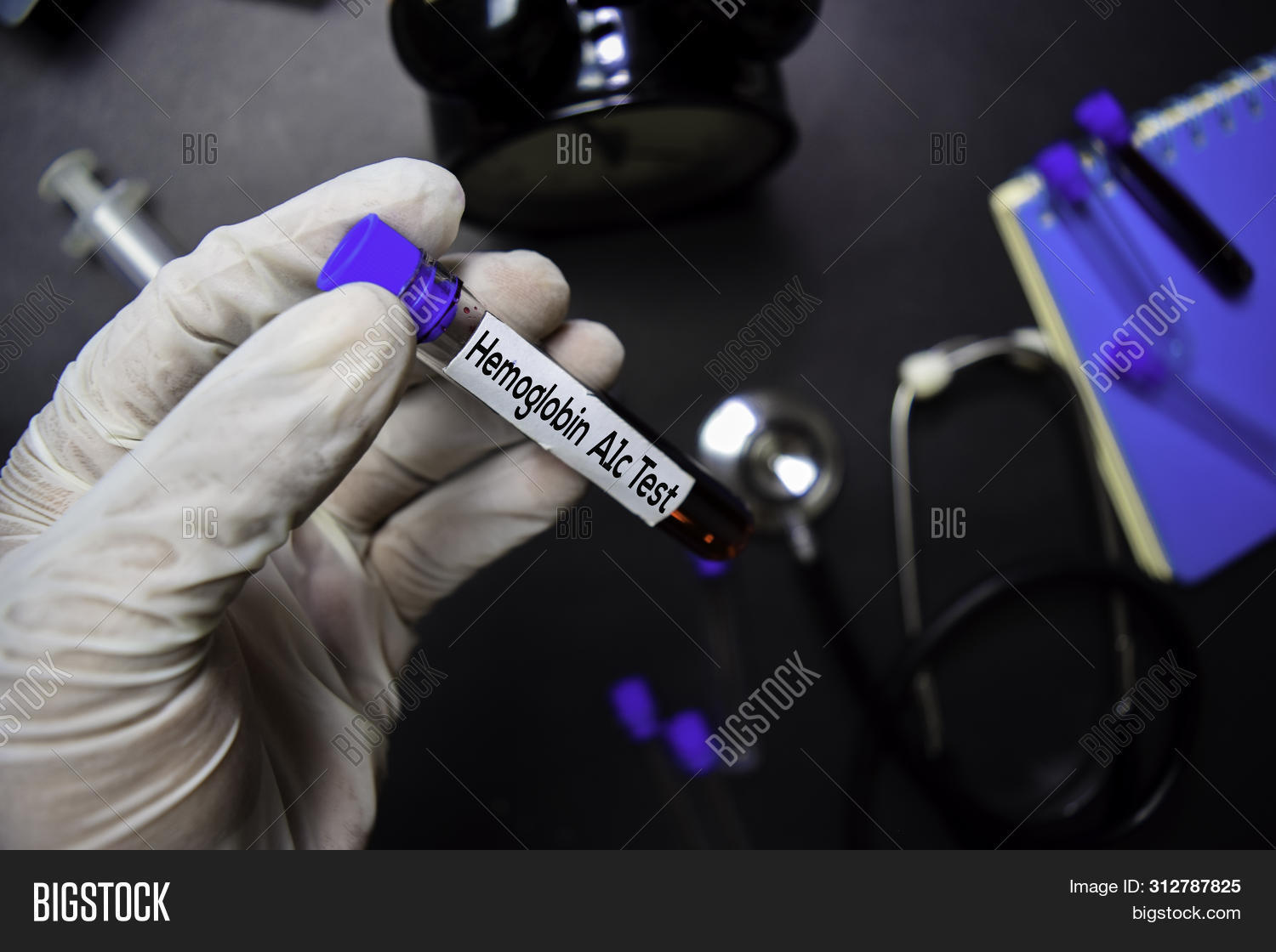 Hemoglobin A1c Test Image & Photo (Free Trial) | Bigstock