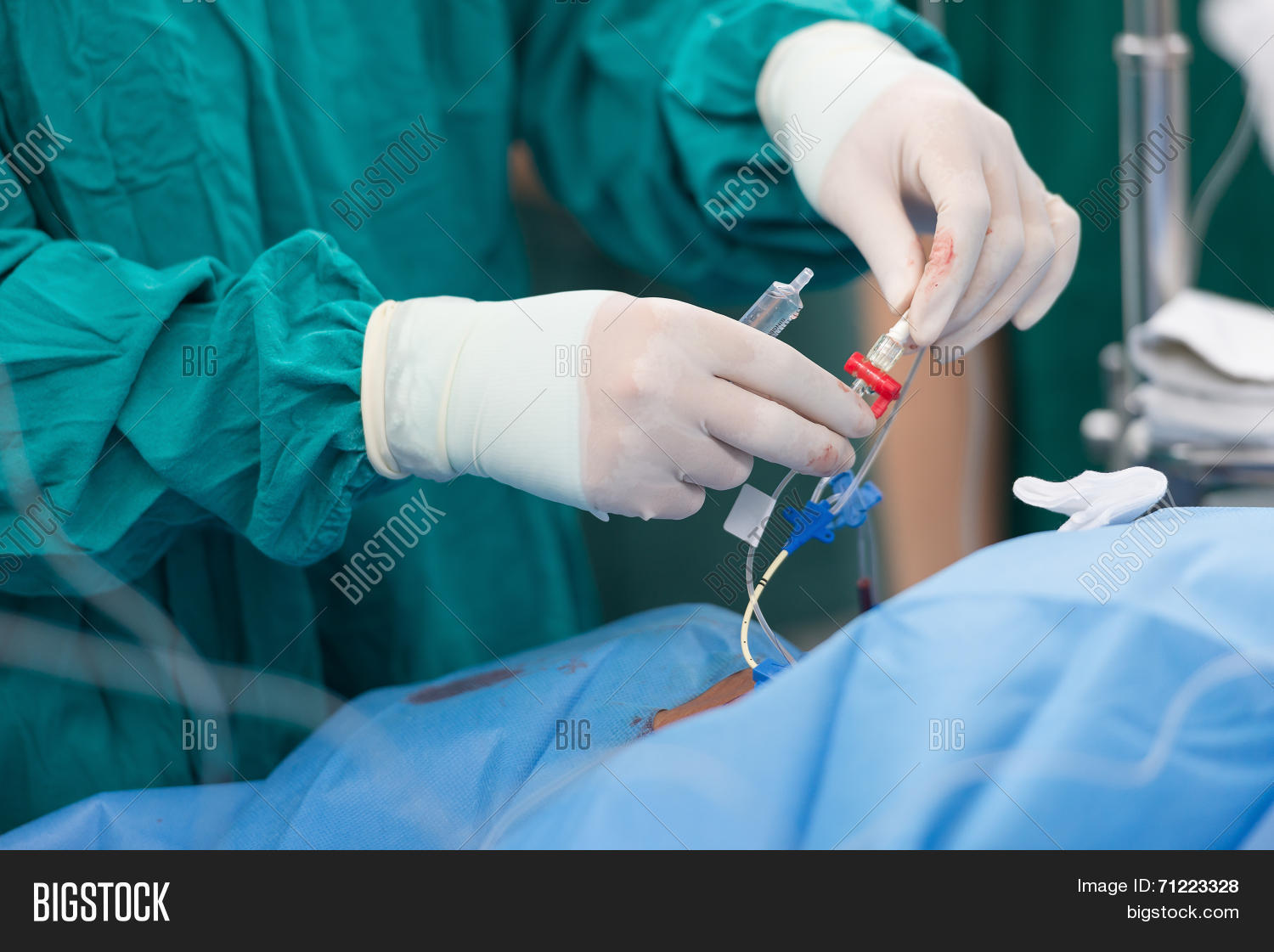 Prepare Central Venous Image & Photo (Free Trial) | Bigstock