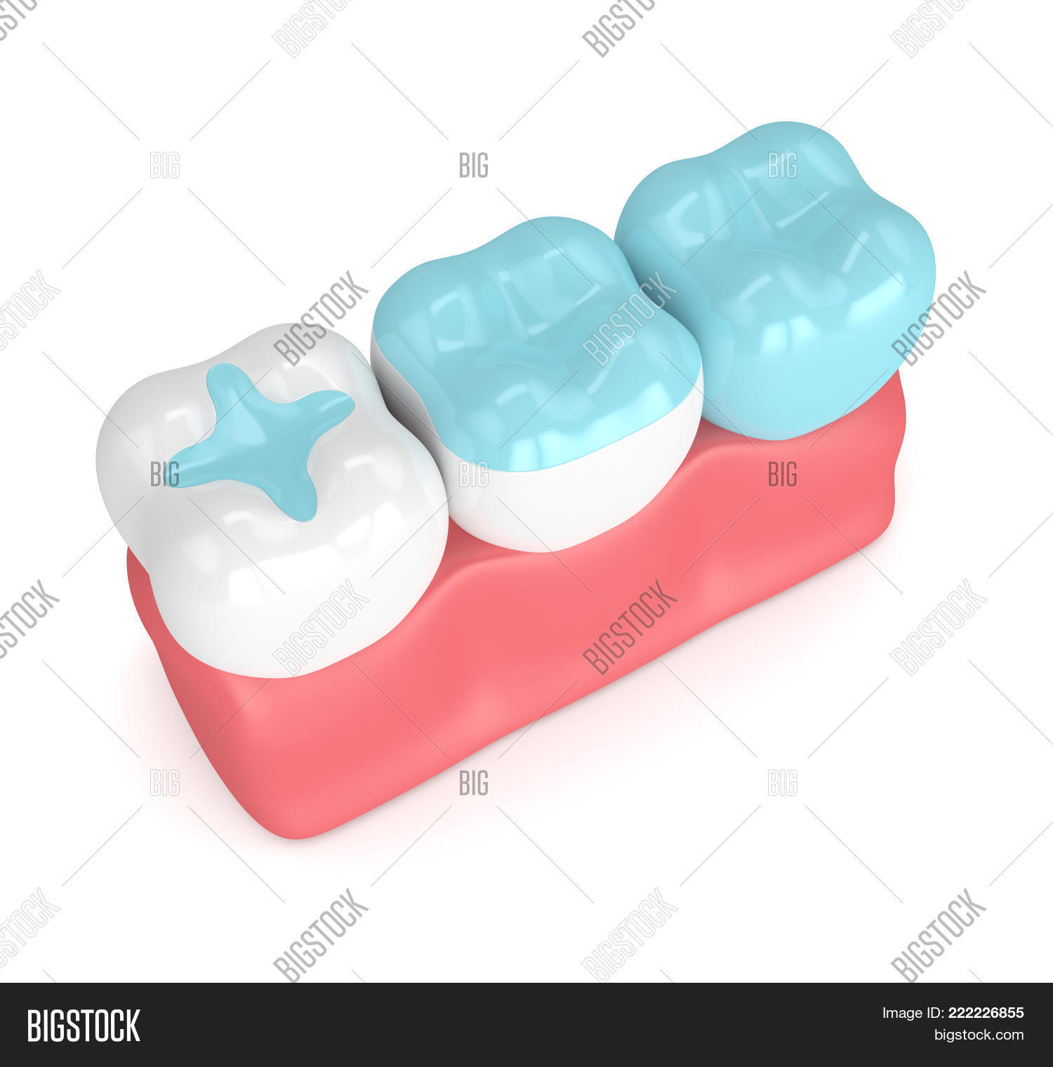 3D Render Teeth Image & Photo (Free Trial) | Bigstock