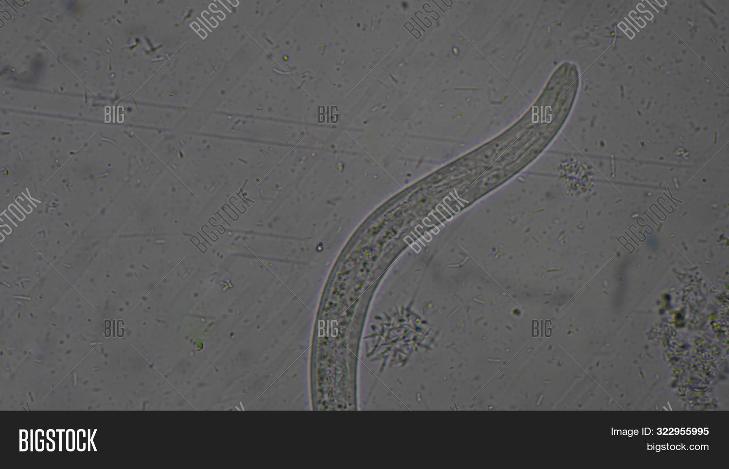 Strongyloides Image & Photo (Free Trial) | Bigstock