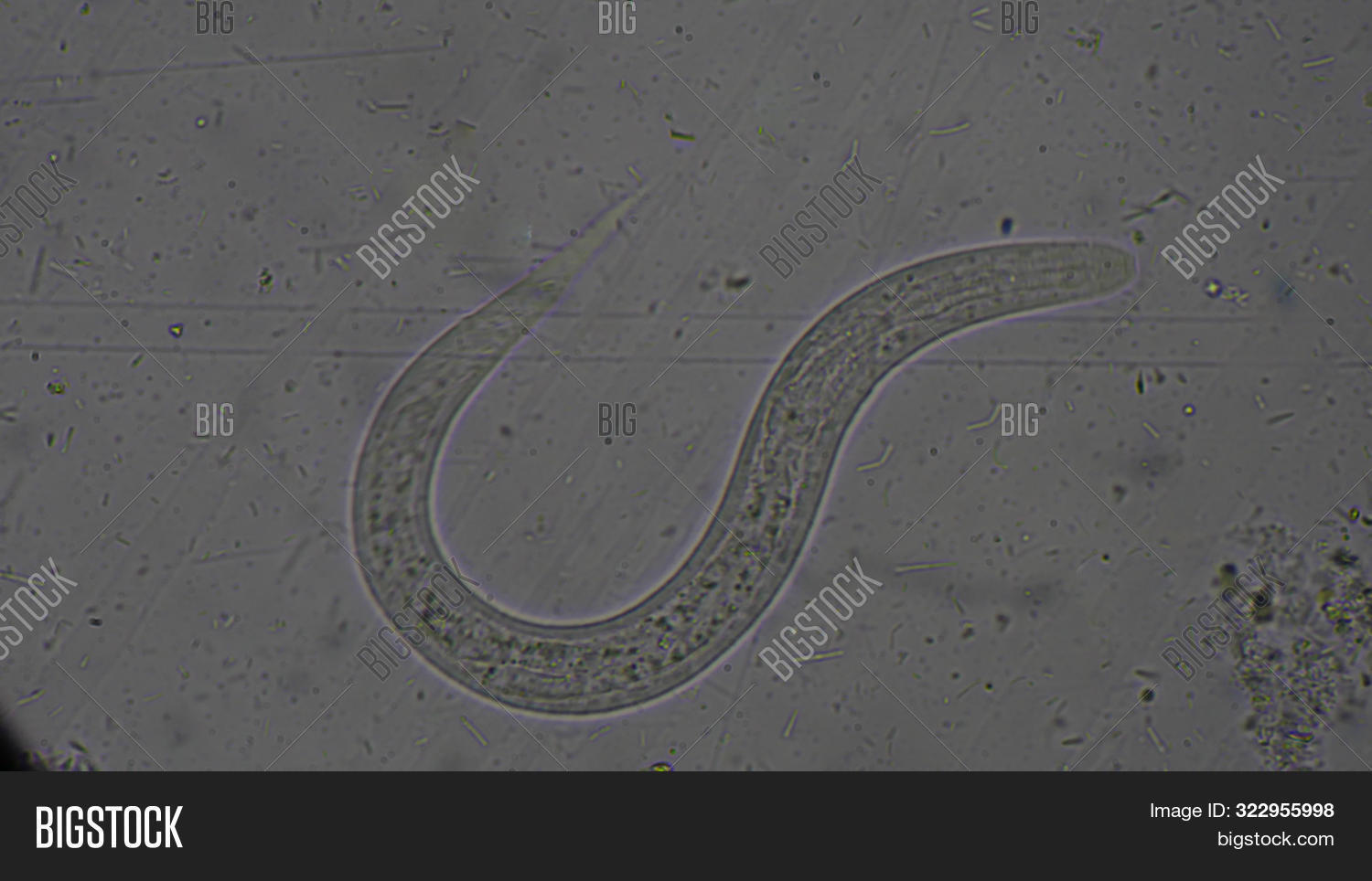 Strongyloides Image & Photo (Free Trial) | Bigstock