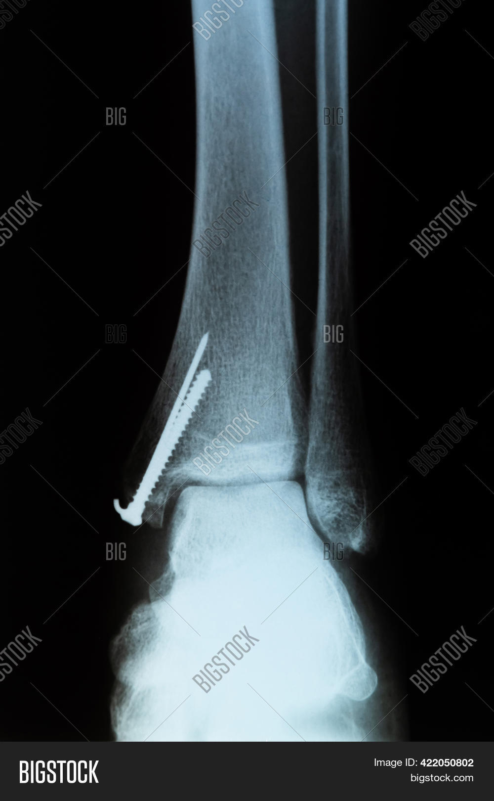Front View X-ray Scan Image & Photo (Free Trial) | Bigstock