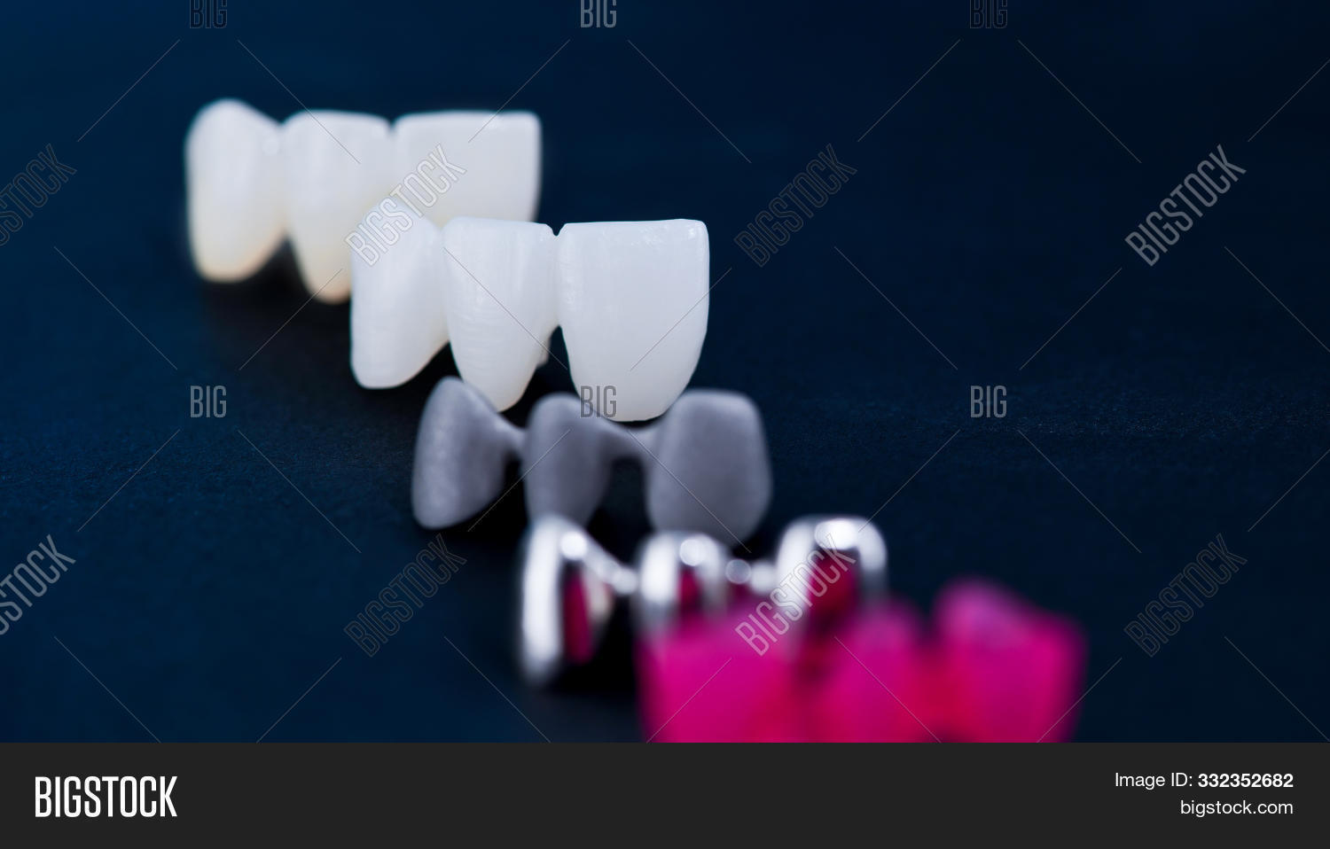 Different Types Dental Image & Photo (Free Trial) | Bigstock