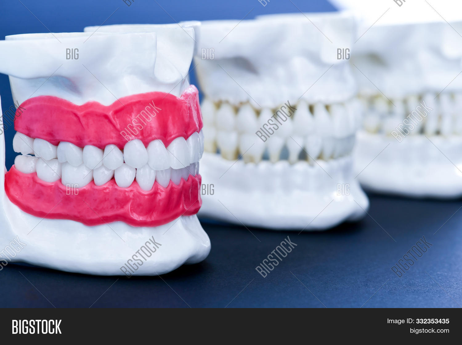 Human Jaws Teeth Gums Image & Photo (Free Trial) | Bigstock