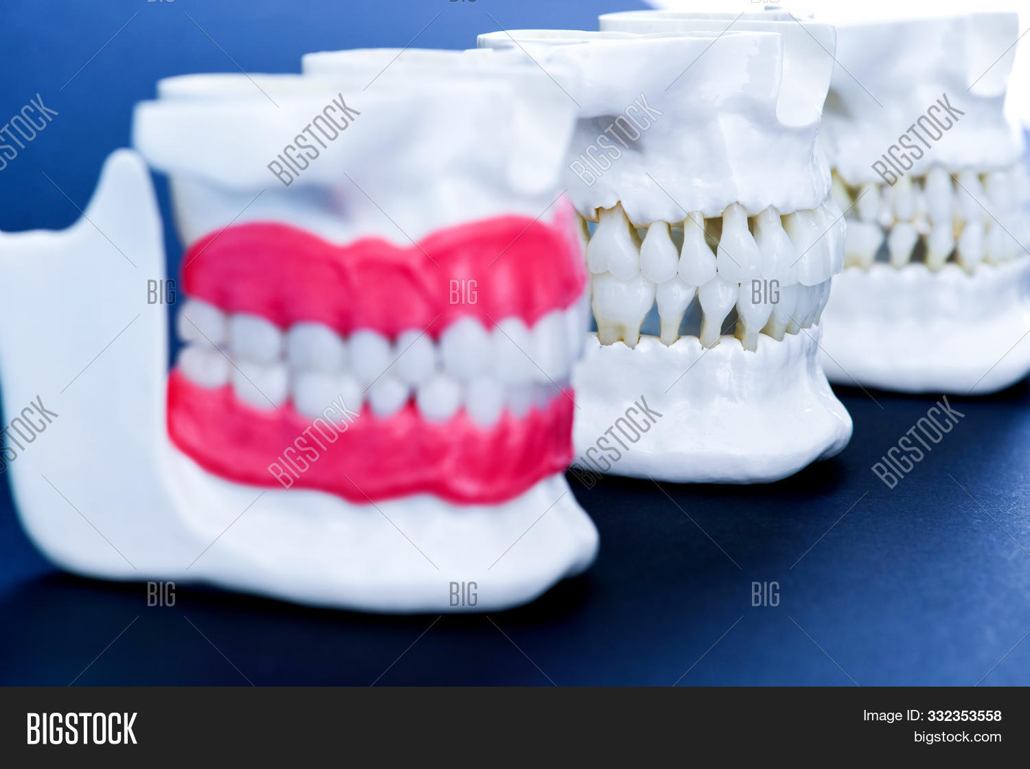 Human Jaws Teeth Gums Image & Photo (Free Trial) | Bigstock