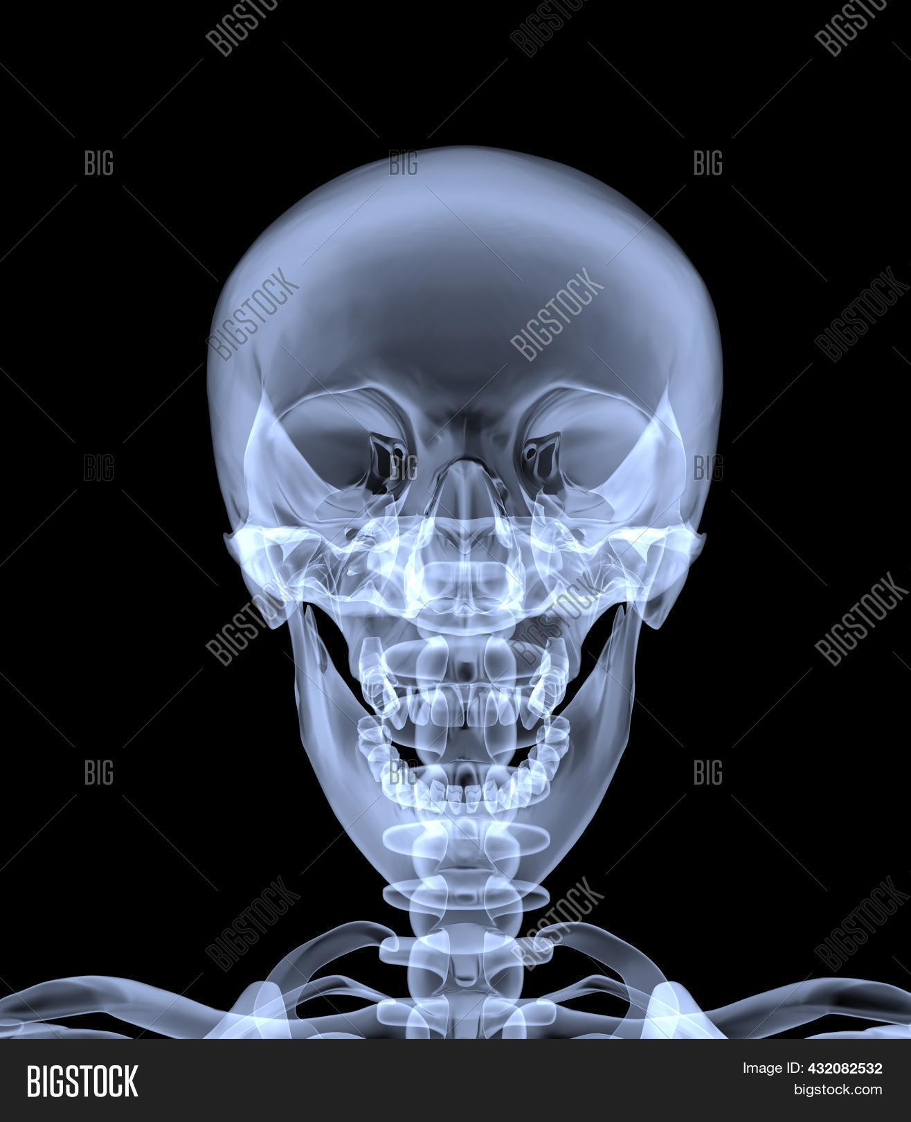 X-ray Human Skull. Image & Photo (Free Trial) | Bigstock