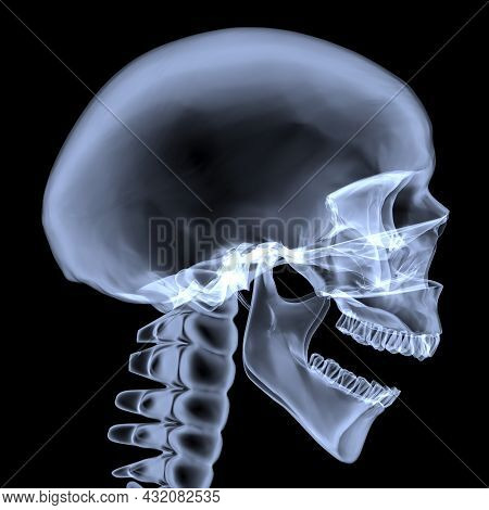 X-ray Human Skull. Image & Photo (Free Trial) | Bigstock