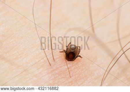 Tick Head Sticking Image & Photo (Free Trial) | Bigstock