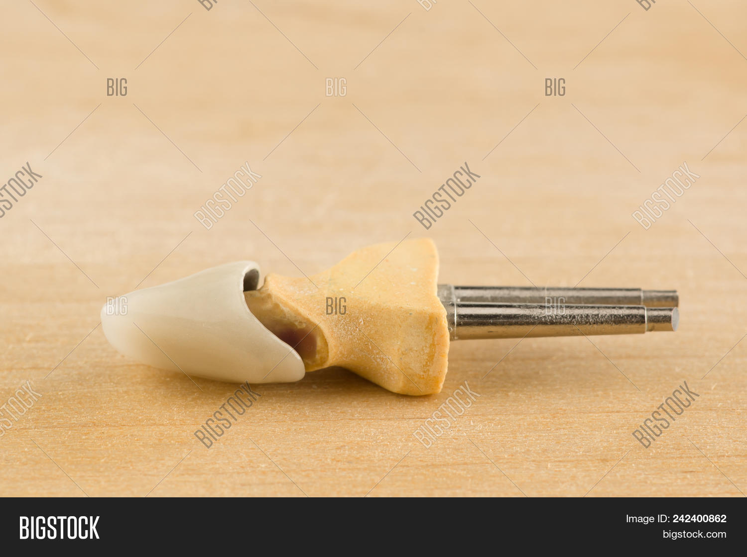 Cast Cermet Dental Image & Photo (Free Trial) | Bigstock