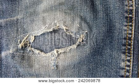 Macro Repaired Torn Image & Photo (Free Trial) | Bigstock