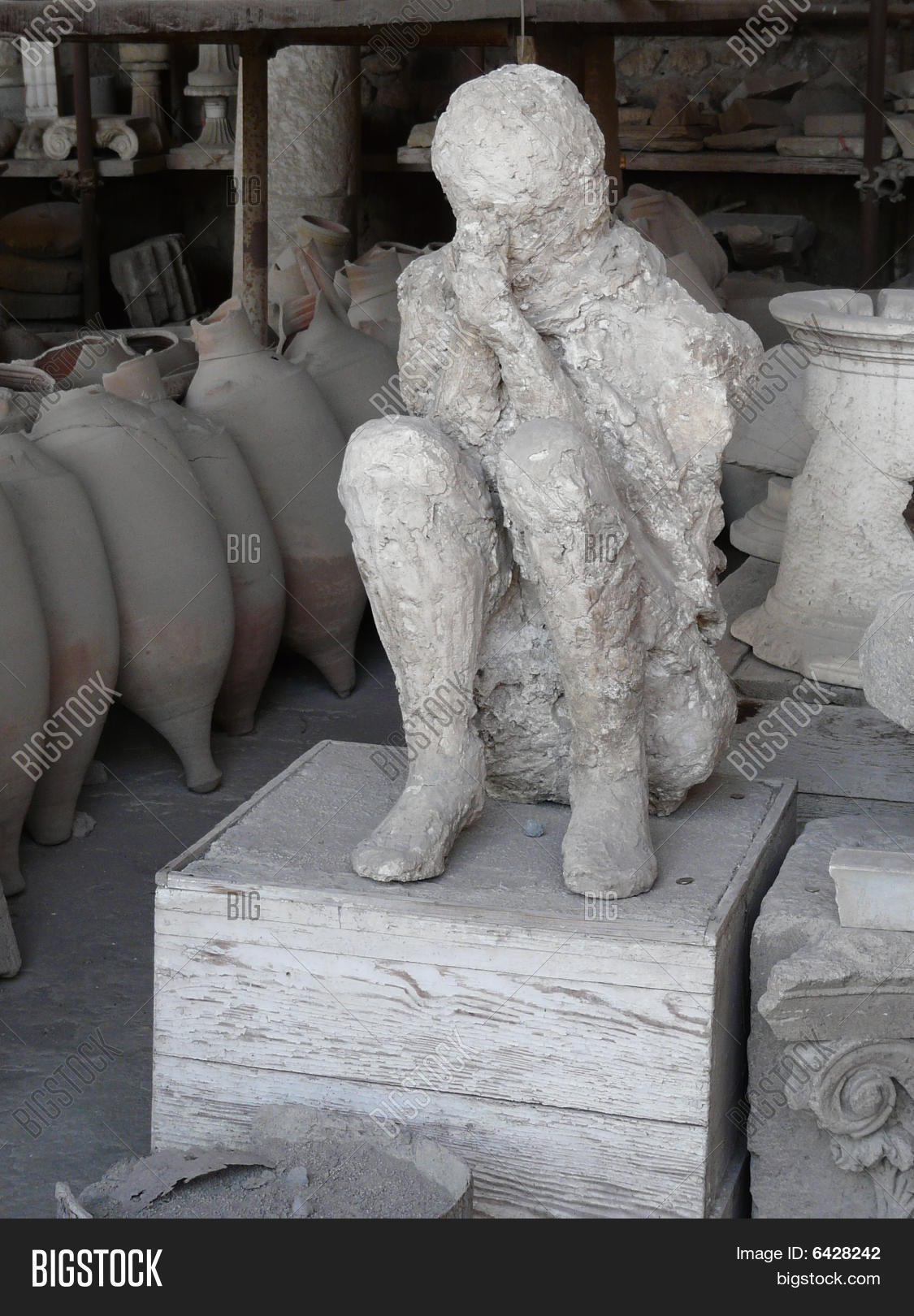 Plaster Cast Body Image & Photo (Free Trial) | Bigstock