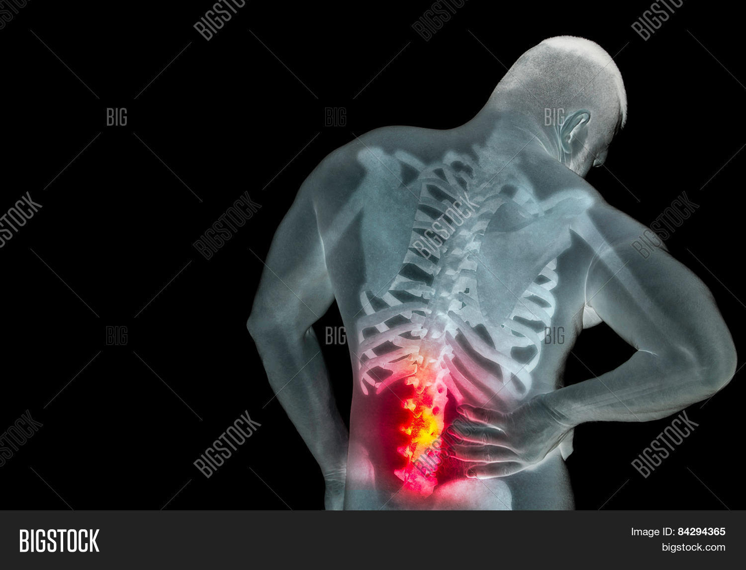 Human Skeleton Under X Image & Photo (Free Trial) | Bigstock