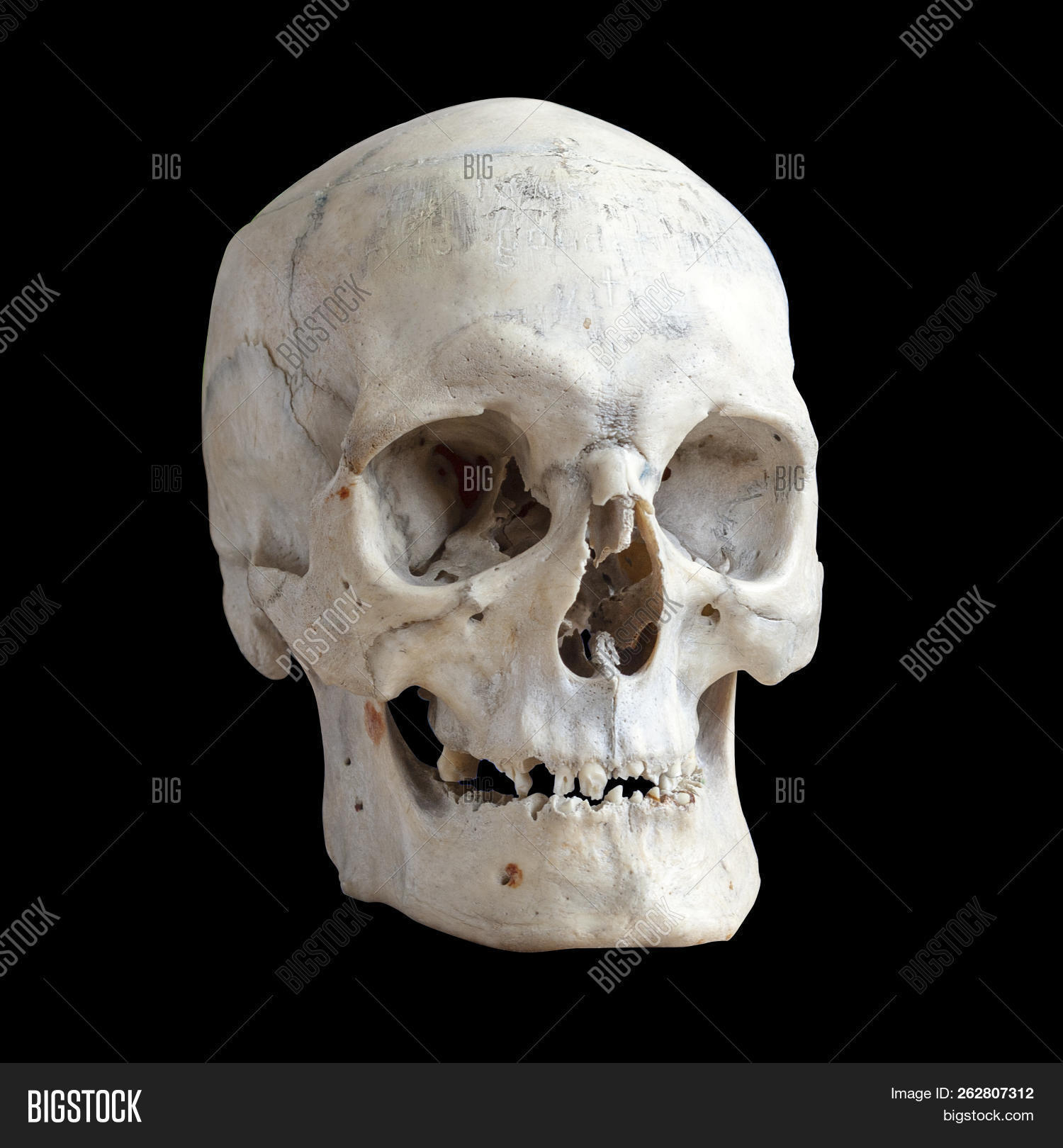 Real Human Skull Pictures