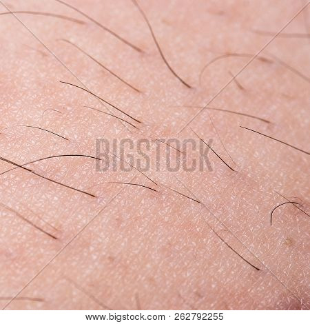 Depilation Sugaring. Image & Photo (Free Trial) | Bigstock